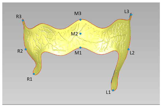 Suitability and Trueness of the Removable Partial Denture Framework ...