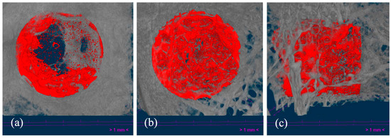 Enhanced Bone Healing in Critical-Sized Rabbit Femoral Defects: Impact ...