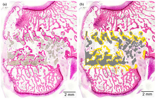 Enhanced Bone Healing in Critical-Sized Rabbit Femoral Defects: Impact ...