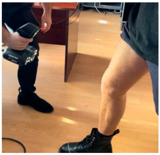 Empowering Rehabilitation: Design and Structural Analysis of a Low-Cost ...