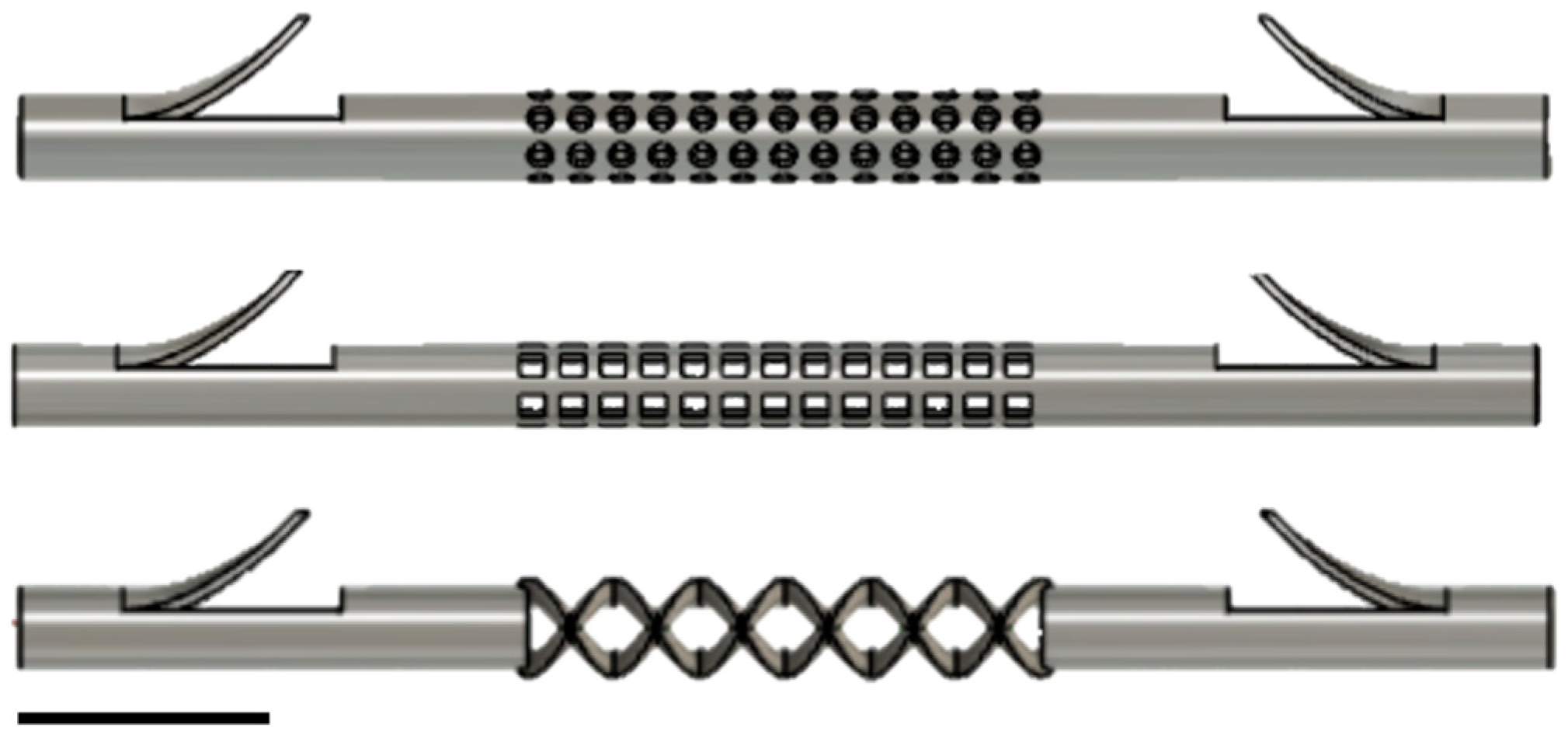 Towards a Customizable, SLA 3D-Printed Biliary Stent: Optimizing a ...