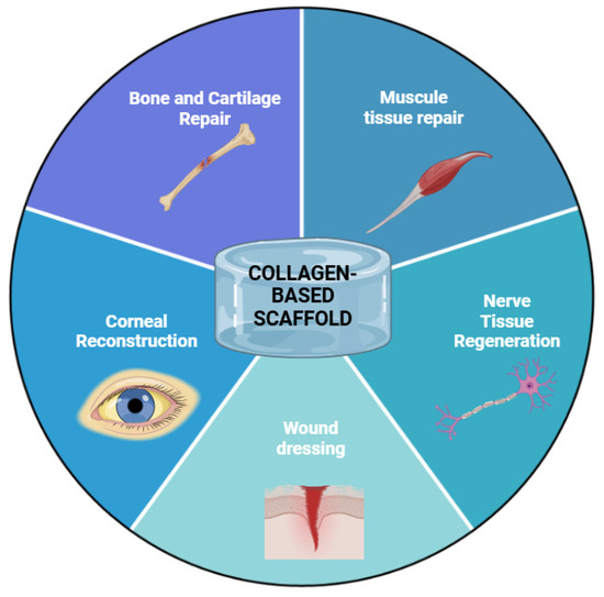 Collagen-Based Scaffolds for Volumetric Muscle Loss Regeneration