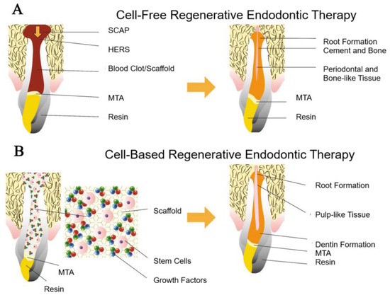 Regenerative Endodontic Therapies: Harnessing Stem Cells, Scaffolds ...