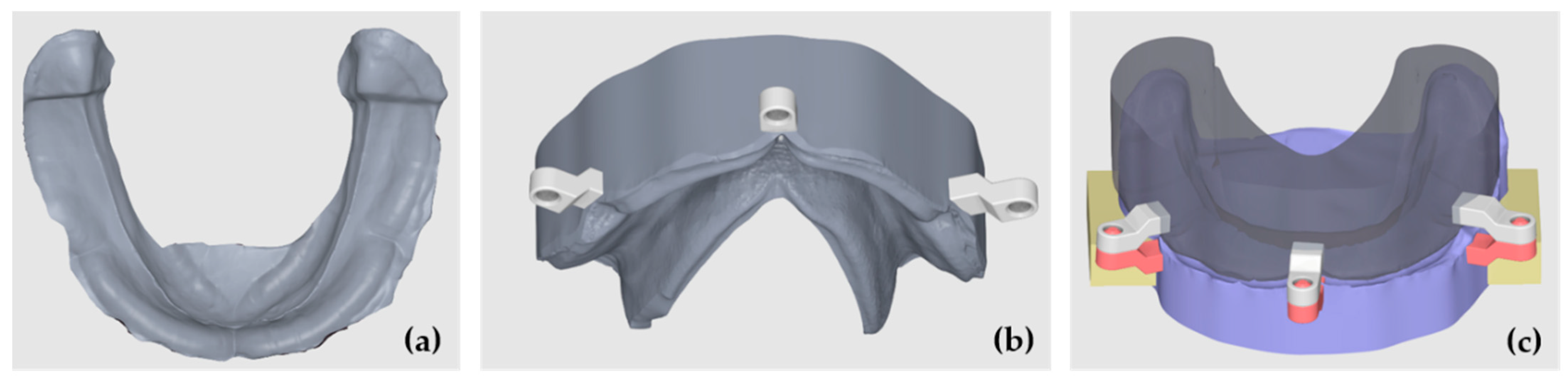 Three-Dimensional Manufacturing of Mandibular Total Edentulous ...
