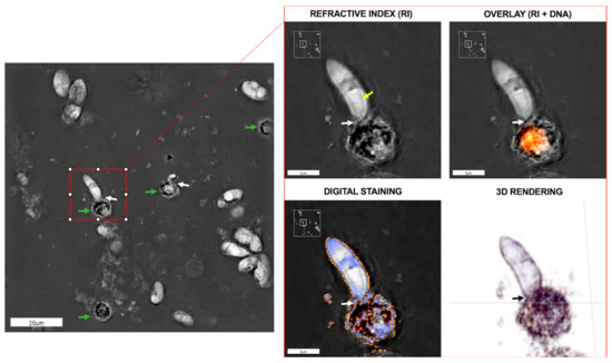 Interaction of Chicken Heterophils and Eimeria tenella Results in ...