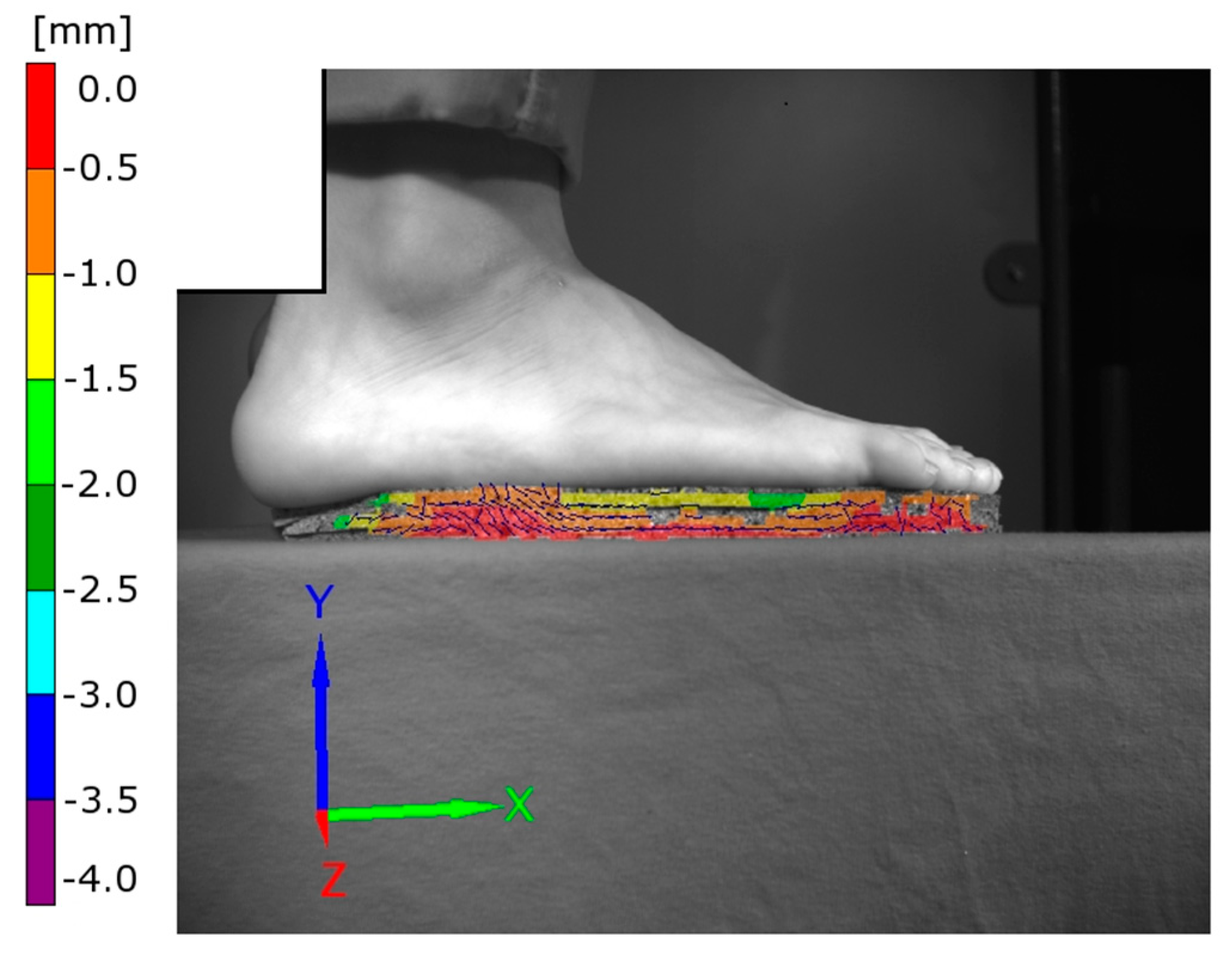 Novel Thermal Analysis Model of the Foot-Shoe Sole Interface during ...
