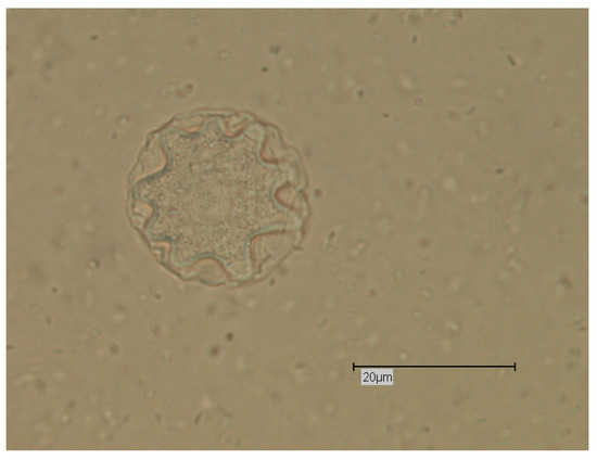 Free-Living Amoebae as Human Parasites and Hosts for Pathogenic ...