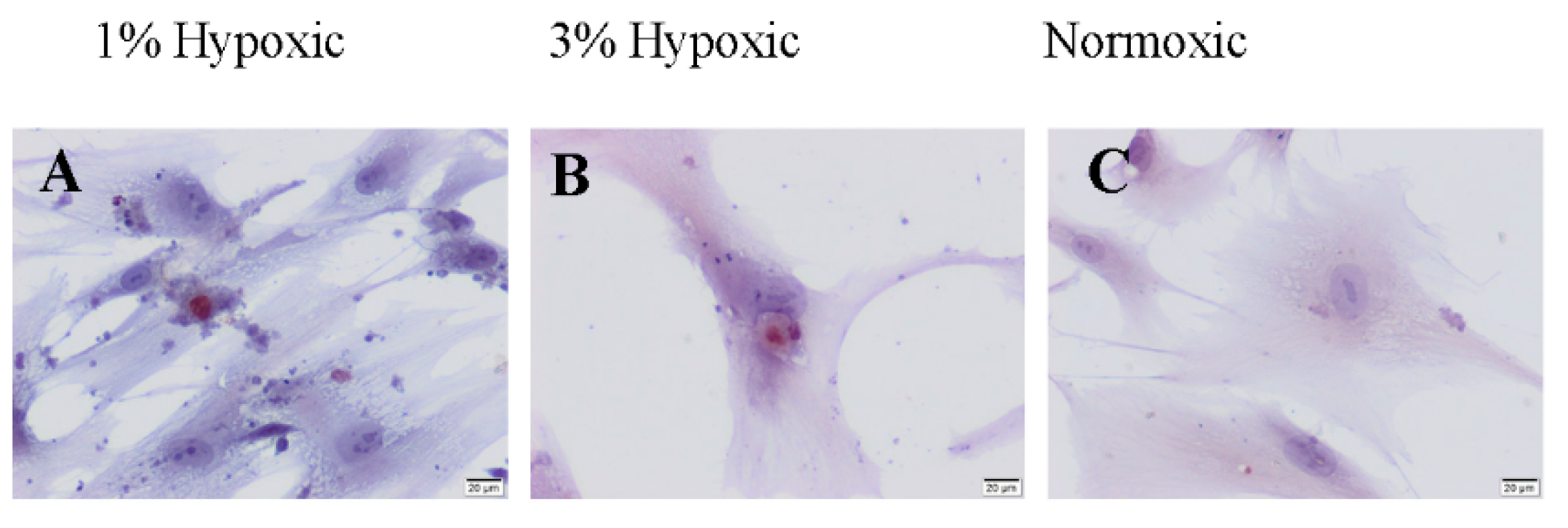 Cytotoxic Effect of Hypoxic Environment in Mesenchymal Stem Cell
