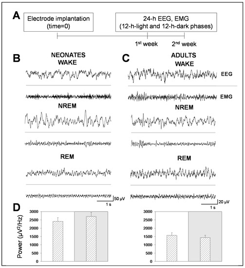 Proceedings | Free Full-Text | Sleep–Wake Cycle and EEG-Based ...