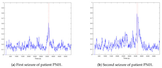 EEG Synchronization Analysis for Seizure Prediction: A Study on Data of ...