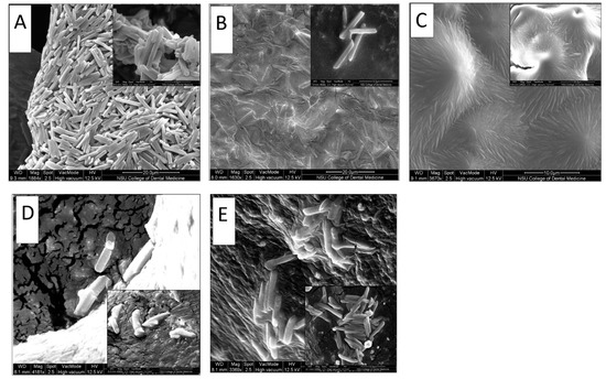 Insulin Release from NPH Insulin-Loaded Pluronic® F127 Hydrogel in the ...