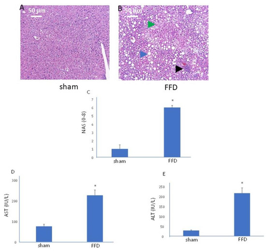 Hepatic mRNA Expression Levels of the Oncogenes Alpha-Fetoprotein and ...
