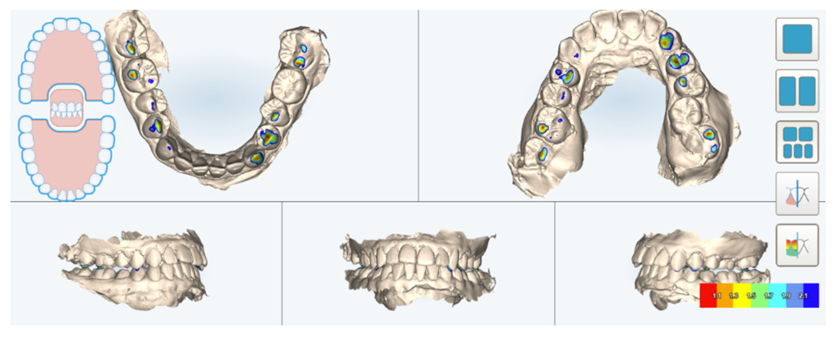 Advanced Digital 3D Technology in the Combined Surgery-First ...