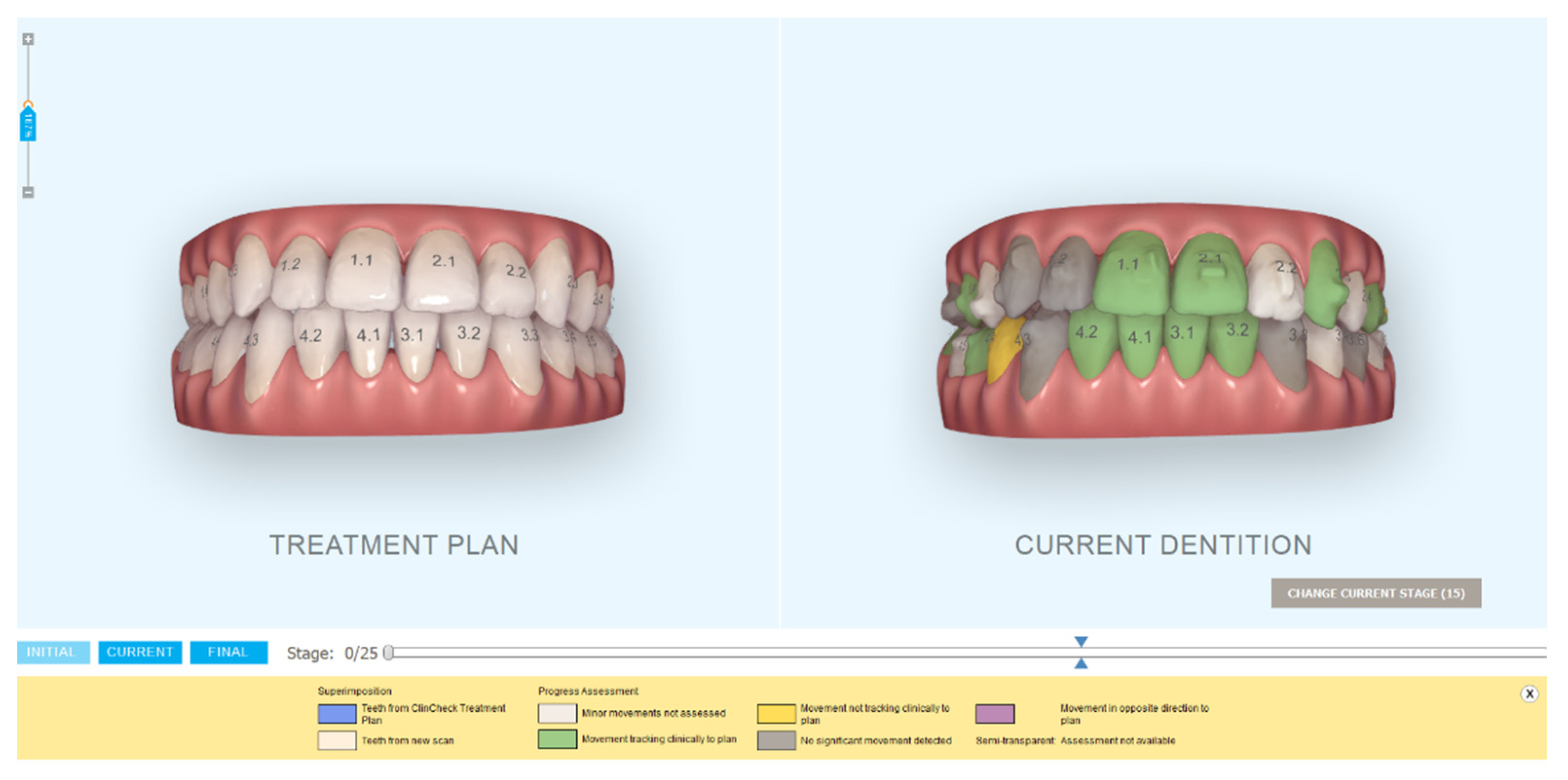 Advanced Digital 3D Technology in the Combined Surgery-First ...