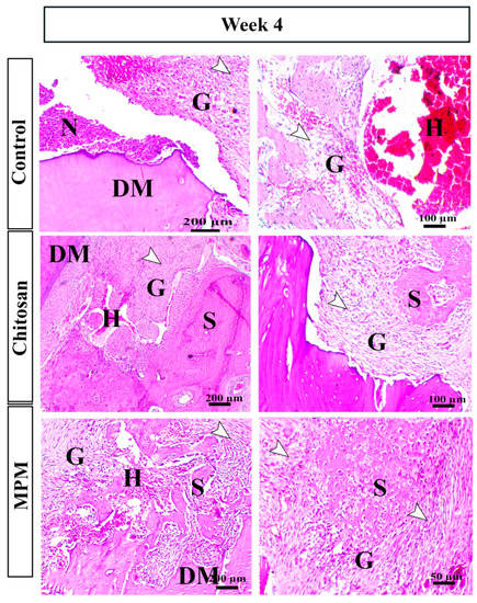 The Effect of Mineralized Plasmatic Matrix and Chitosan on the Healing ...