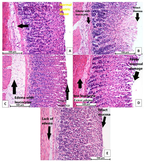 Gastroprotective, Biochemical and Acute Toxicity Effects of Papaver ...