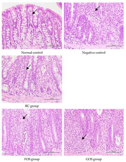 Bacillus coagulans BACO-17 Alone or in Combination with Galacto ...