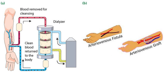 Flexible Ring Sensor Array and Machine Learning Model for the Early ...