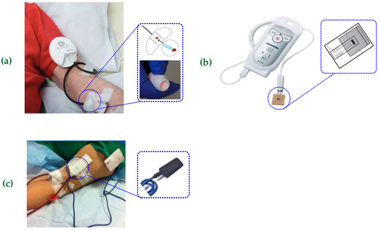 Processes | Free Full-Text | Flexible Ring Sensor Array and Machine ...
