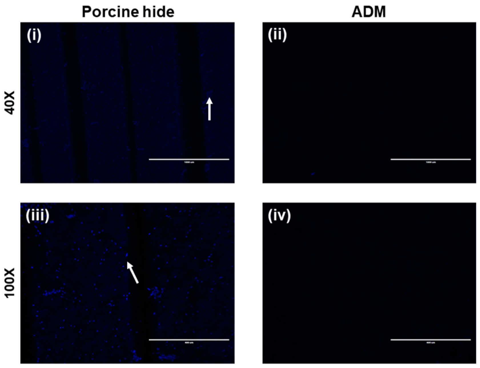 Efficacy of Supercritical Fluid Decellularized Porcine Acellular Dermal Matrix in the Post ...