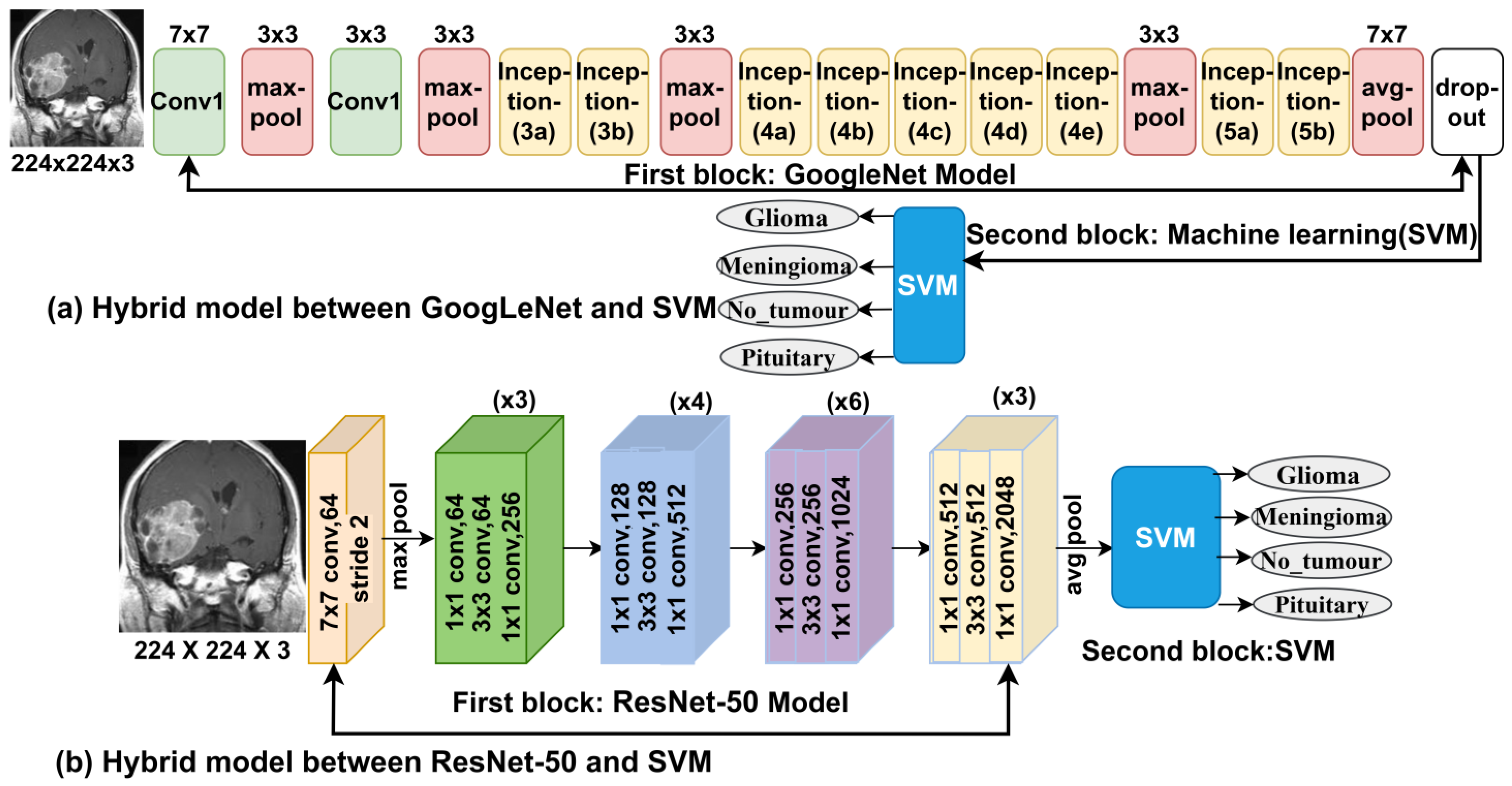 Hybrid Techniques of Analyzing MRI Images for Early Diagnosis of Brain ...