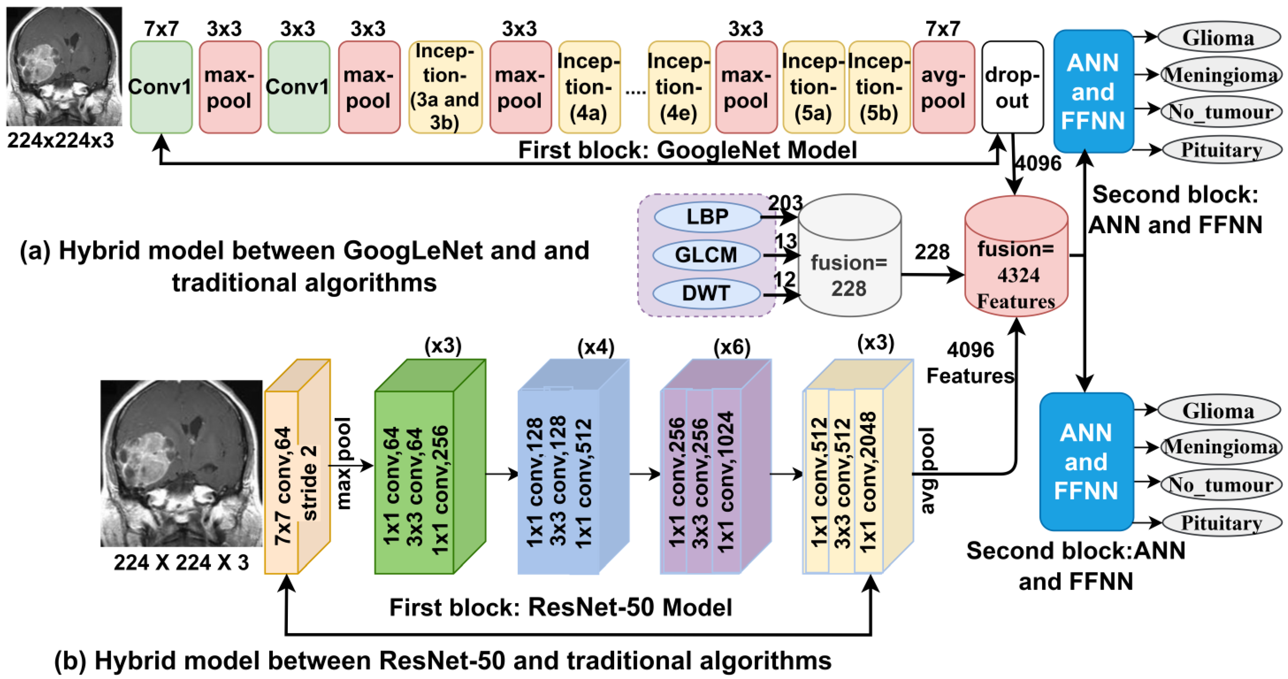Hybrid Techniques of Analyzing MRI Images for Early Diagnosis of Brain ...
