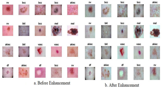 Multi-Models of Analyzing Dermoscopy Images for Early Detection of Multi-Class Skin Lesions ...