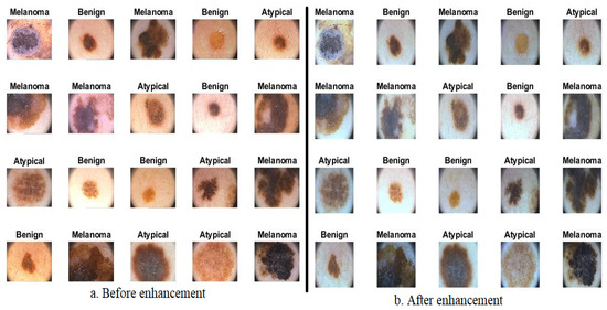Multi-Models of Analyzing Dermoscopy Images for Early Detection of ...