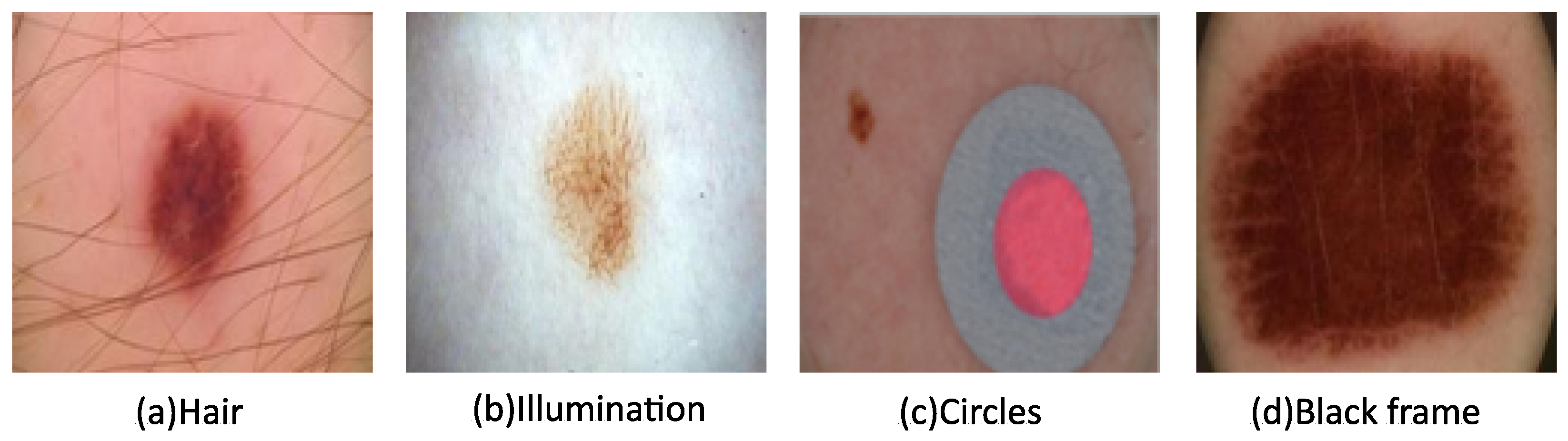 Machine Learning Methods in Skin Disease Recognition: A Systematic Review