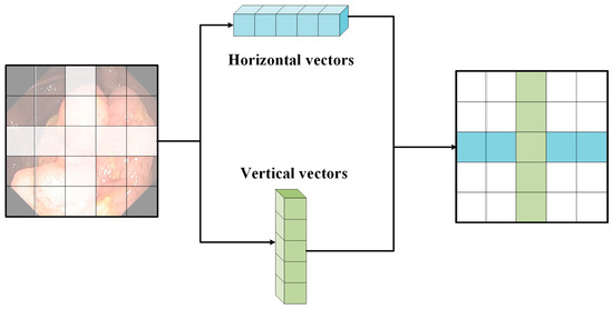 GCCSwin-UNet: Global Context and Cross-Shaped Windows Vision ...