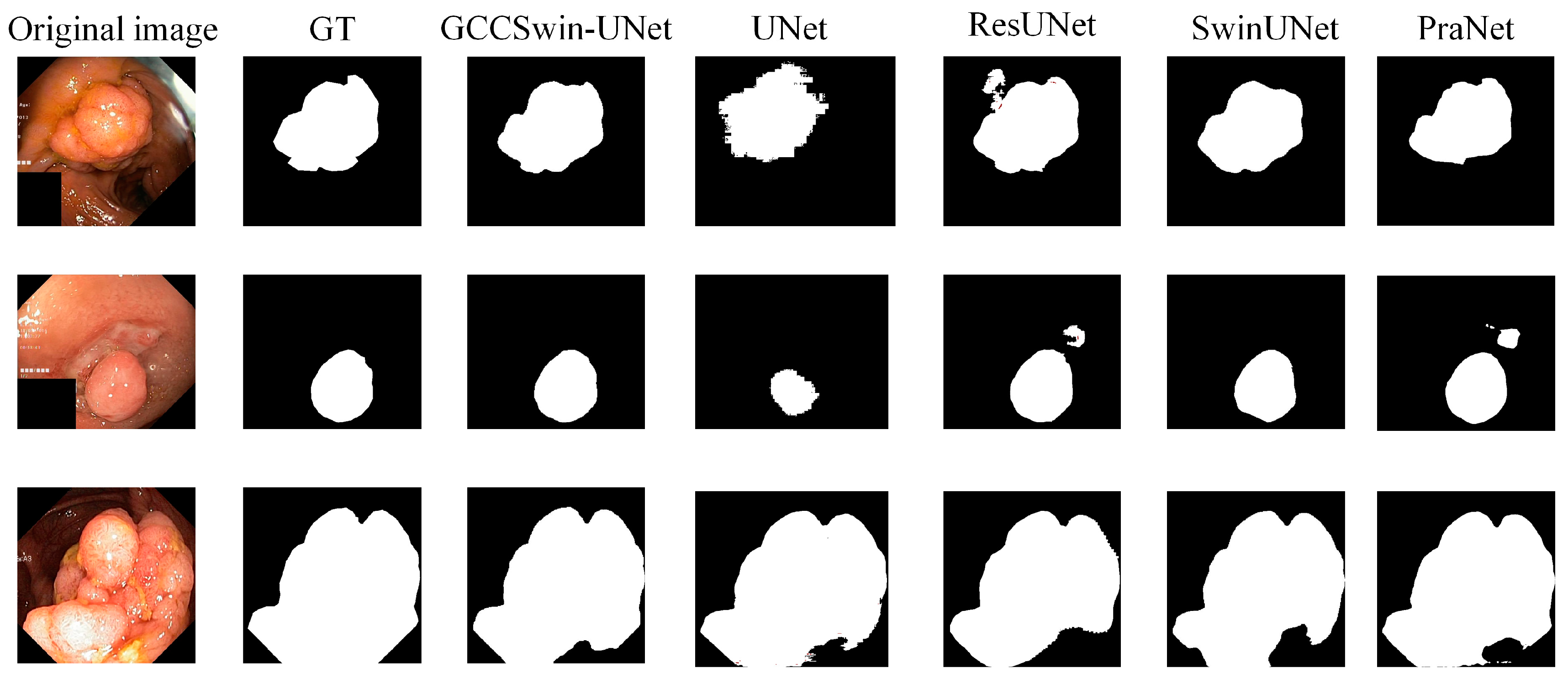 GCCSwin-UNet: Global Context and Cross-Shaped Windows Vision Transformer Network for Polyp ...