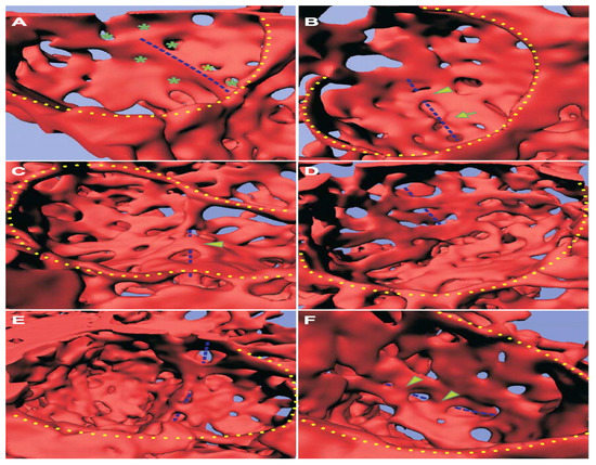 Review of Motion Simulation of Particulate Matter in the Respiratory ...