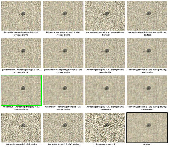 Design and Implementation of Defect Detection System Based on YOLOv5 ...