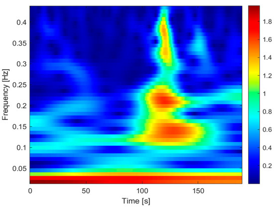 Wear Detection of Extruder Elements Based on Current Signature by Means ...