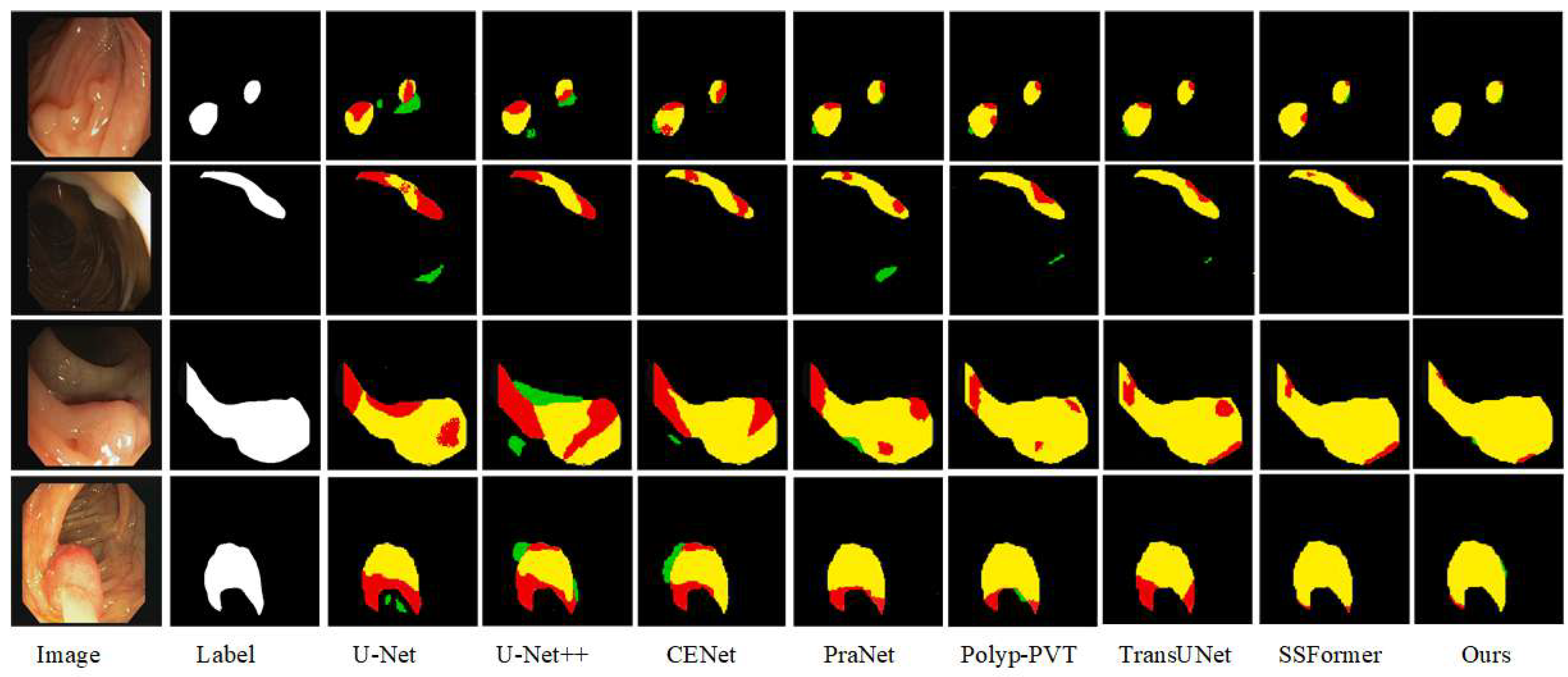 Processes | Free Full-Text | Improving Polyp Segmentation with Boundary ... Processes | Free Full-Text | Improving Polyp Segmentation with Boundary ...