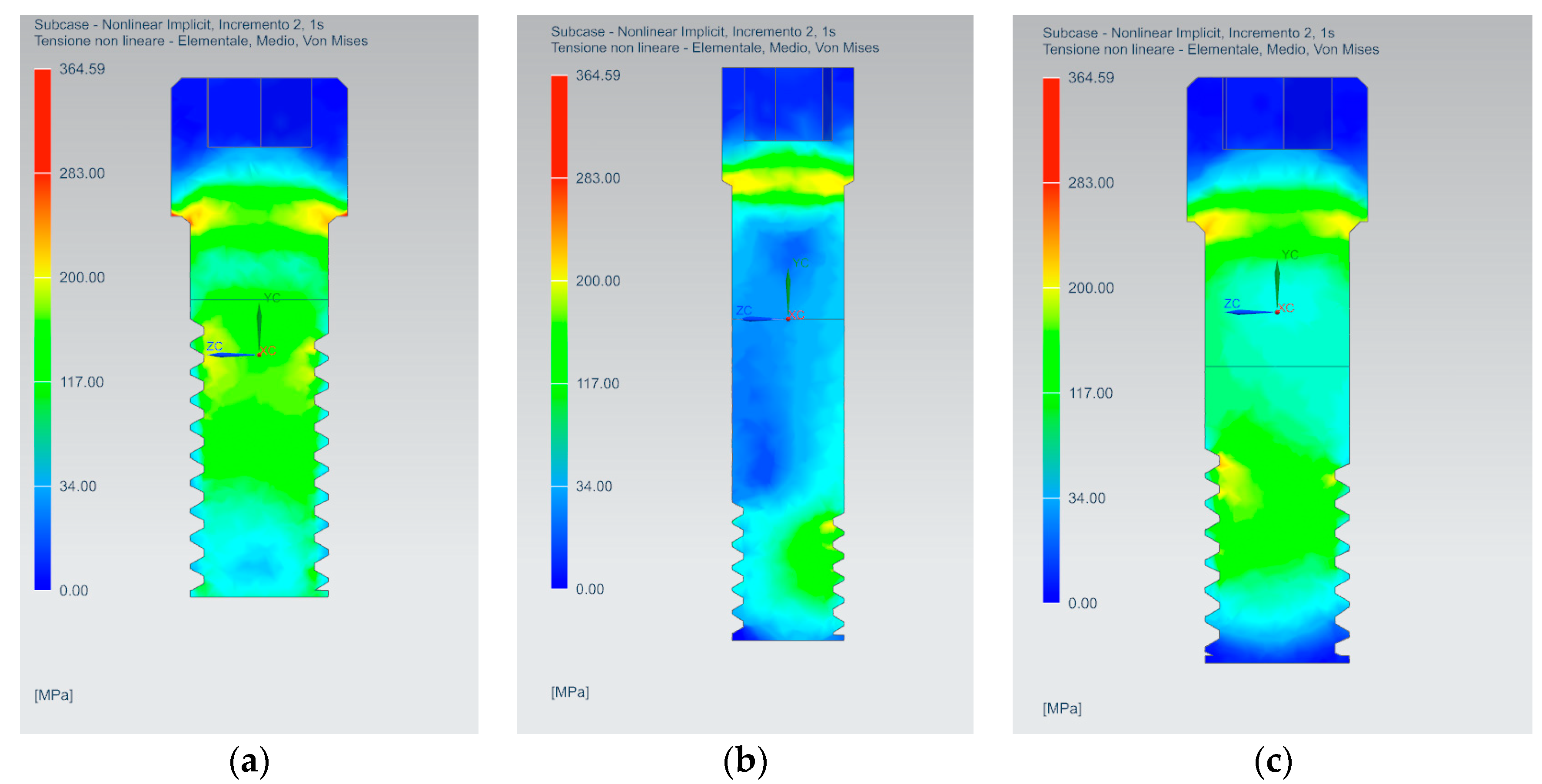 Prosthetic and Mechanical Parameters of the Facial Bone under the Load ...