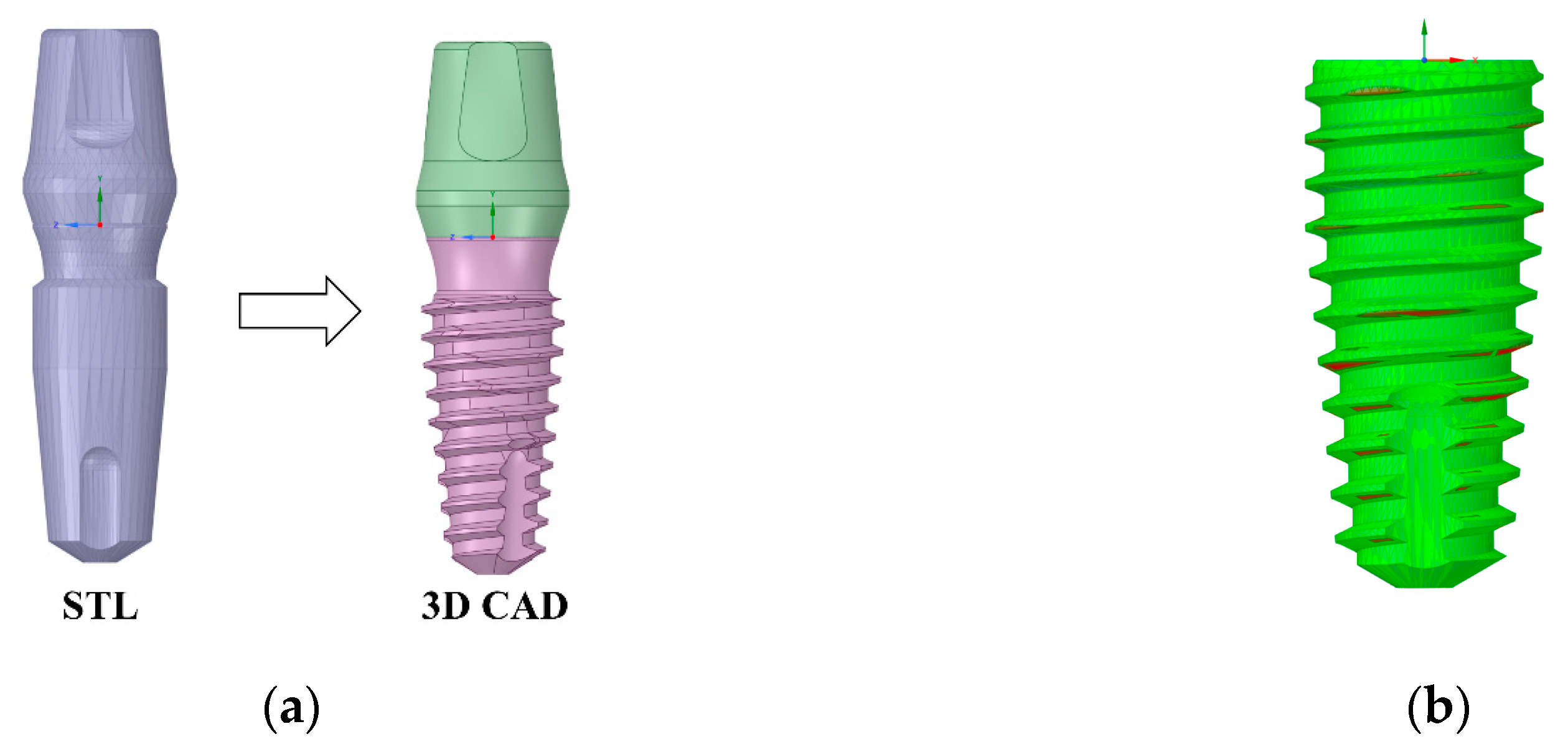 Prosthetic and Mechanical Parameters of the Facial Bone under the Load ...