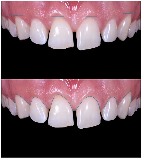 Prosthesis | An Open Access Journal from MDPI