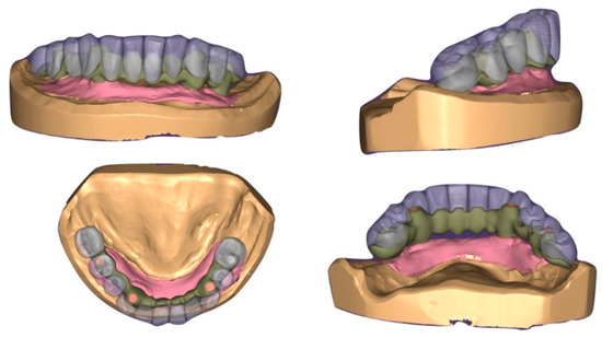 A One-Year, Multicenter, Retrospective Evaluation of Narrow and Low ...