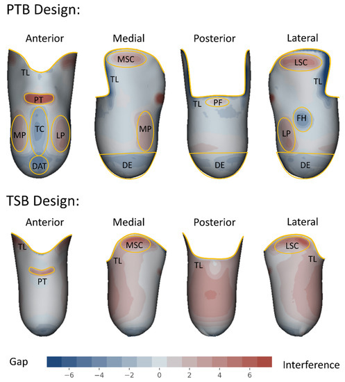 Characterising Residual Limb Morphology and Prosthetic Socket Design ...