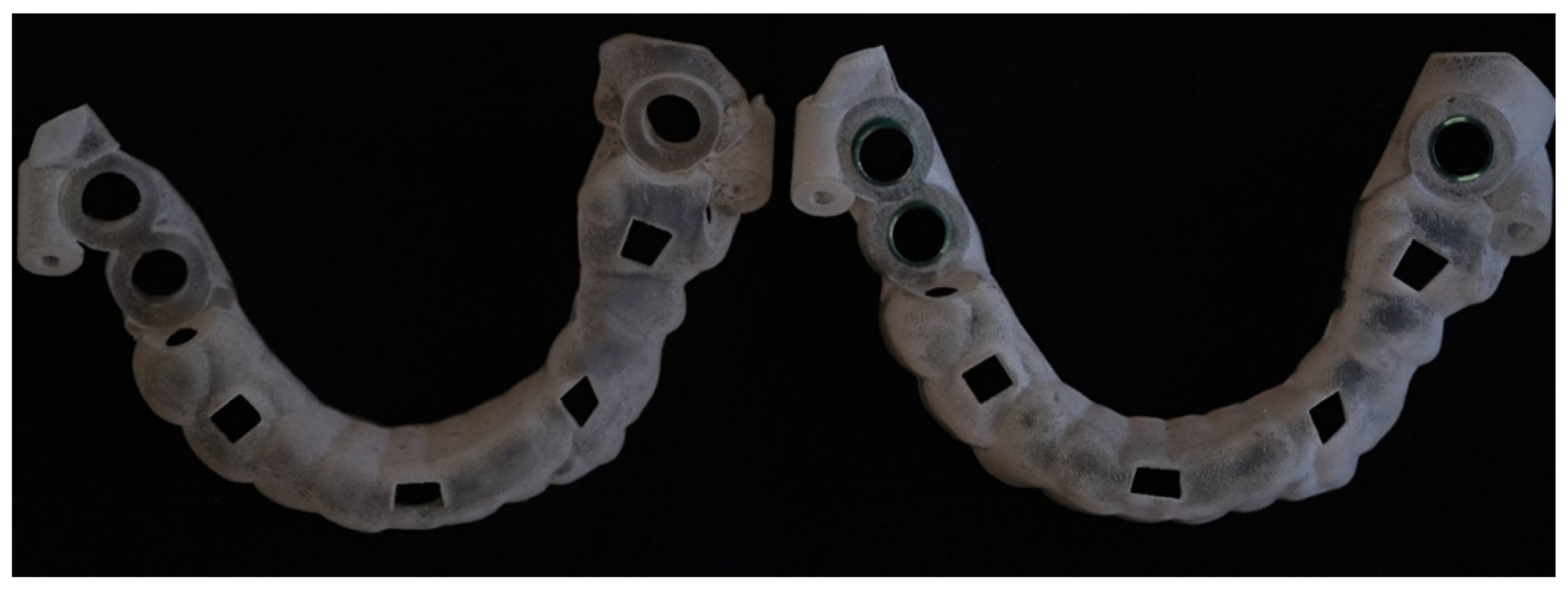 Prosthetic Surgical Templates and Dental Implant Site Time Preparation ...