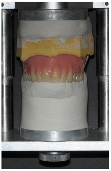 Comparison of the Accuracy between Denture Bases Produced by ...