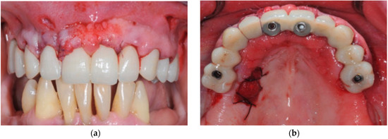 Prosthesis | An Open Access Journal from MDPI
