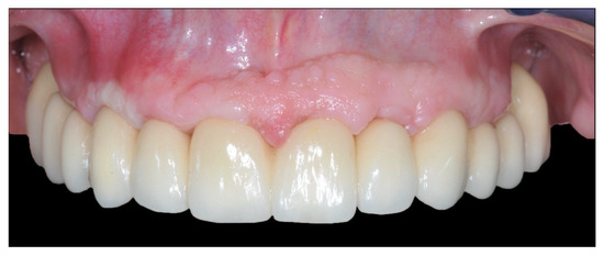 Prosthesis | An Open Access Journal from MDPI