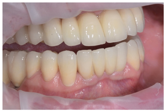 Prosthesis | An Open Access Journal from MDPI