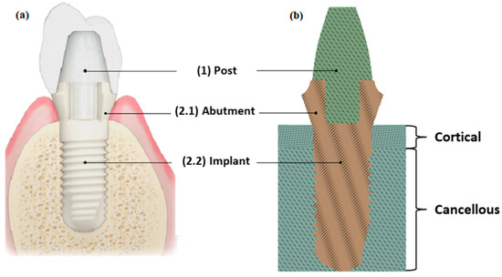 Prosthesis | An Open Access Journal from MDPI