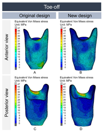 Design Evaluation of FFF-Printed Transtibial Prosthetic Sockets Using Follow-Up and Finite ...