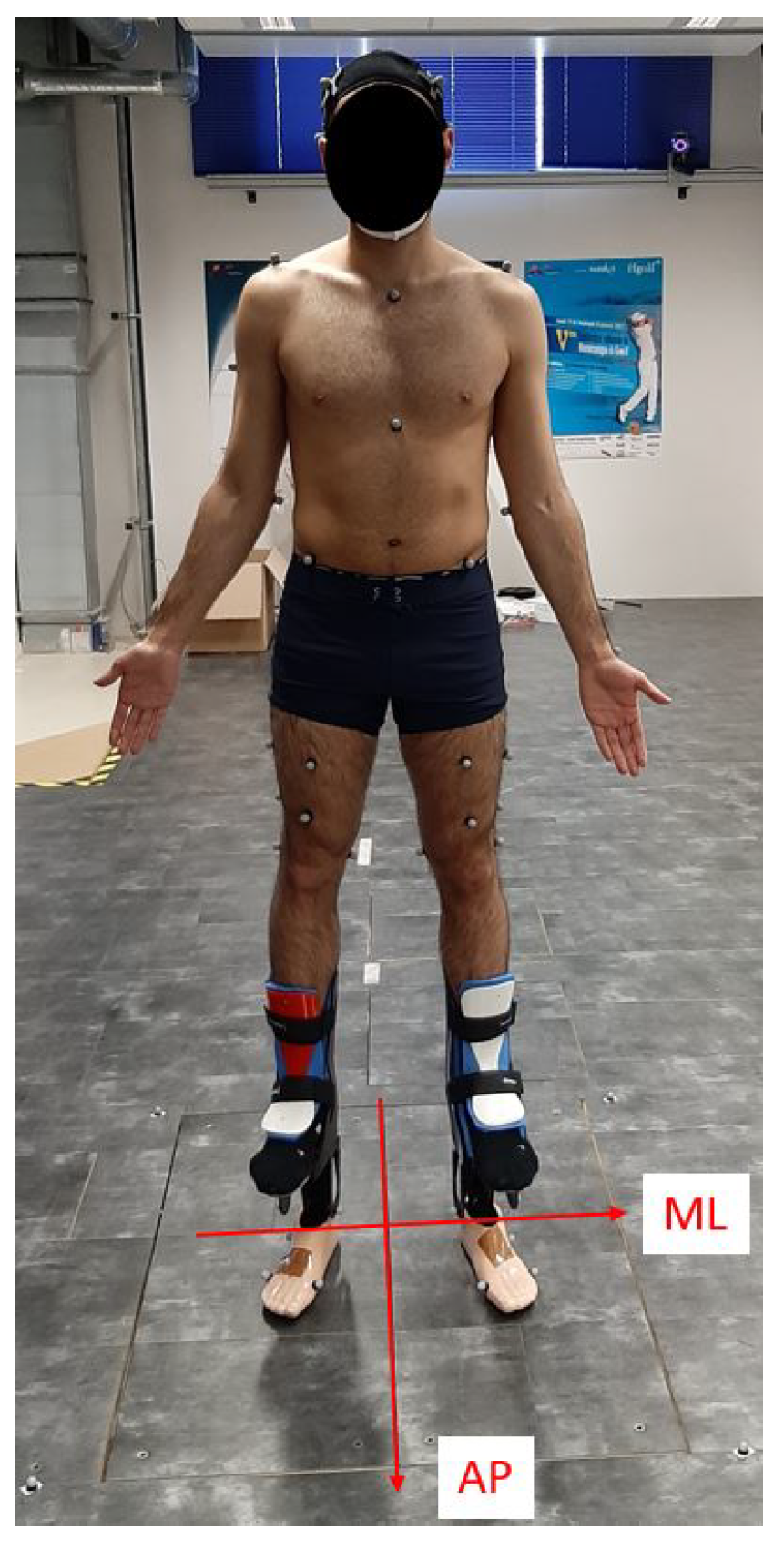 Quantification of the Influence of Prosthetic Ankle Stiffness on Static ...