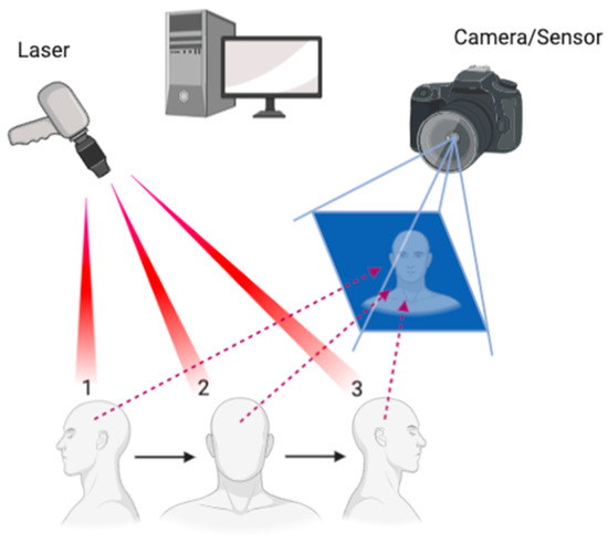 Facial Scanners in Dentistry: An Overview