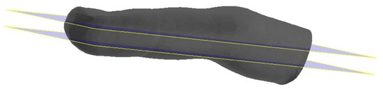 Conceptualization of an Anthropomorphic Replacement Hand with a Sensory ...